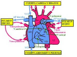 Cardiopatías congénitas / Defectos del corazón – Infogen